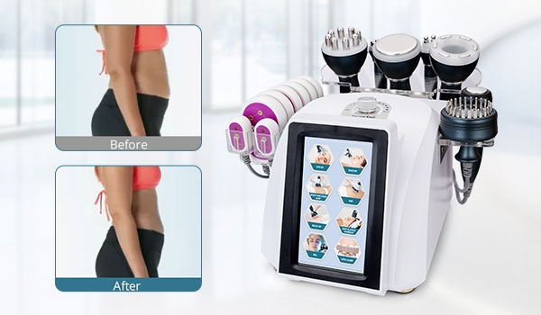 How To Buy An Ultrasound Fat-Reducing Machine?